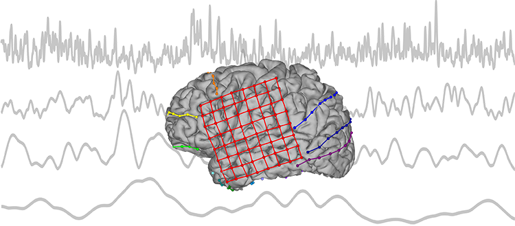 Decoding Inner Language To Treat Speech Disorders Department Of Basic