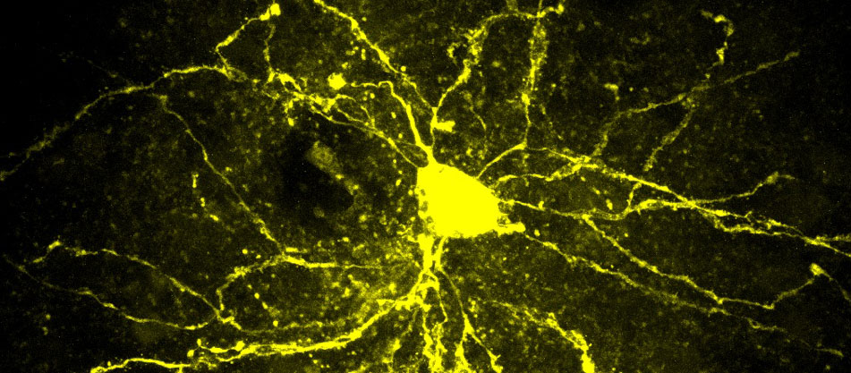 Gene-environment interactions that drives autism - Department of Basic ...